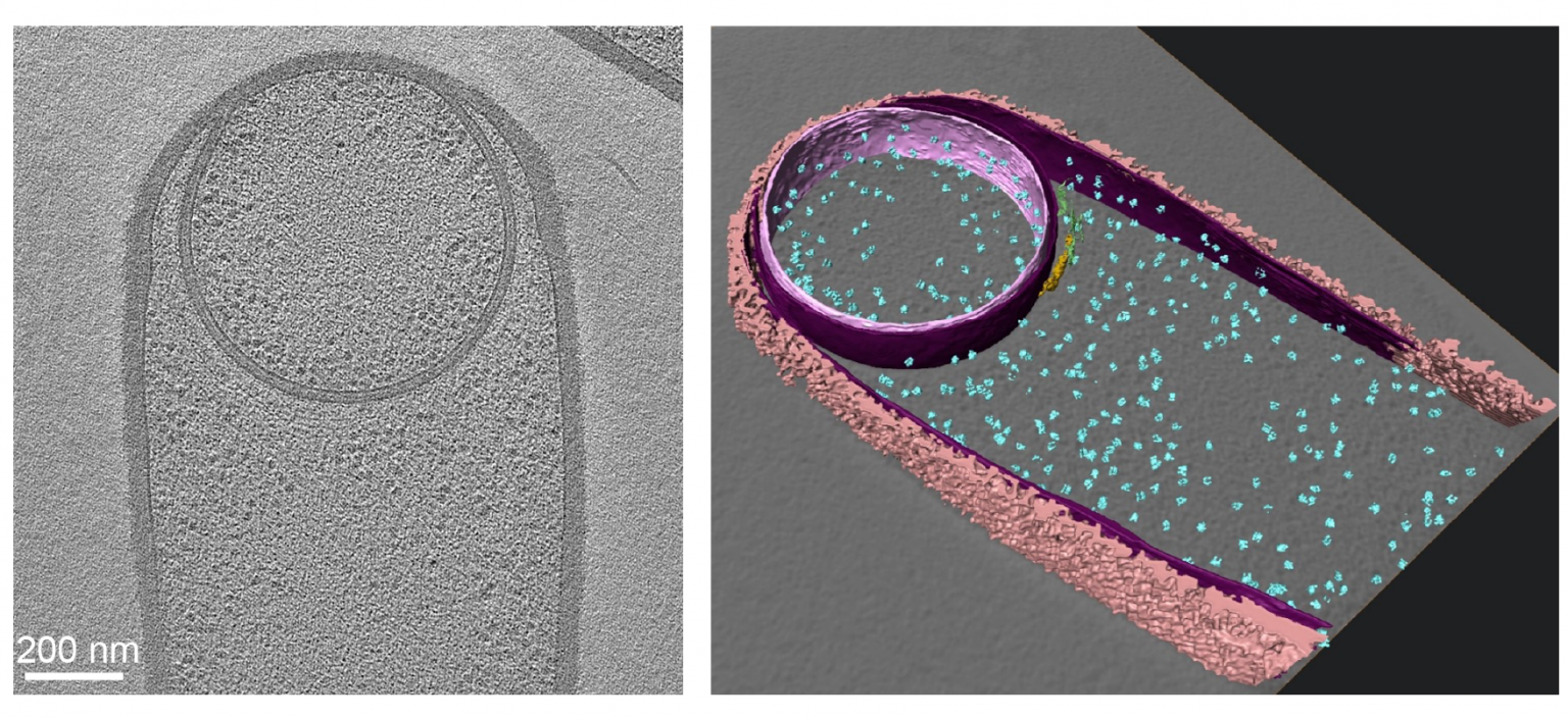 Cryo-electron microscopy (Cryo-EM) Archives - FocalPlane