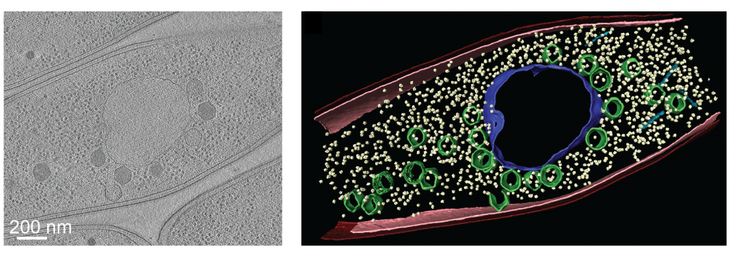 Cryo-electron microscopy (Cryo-EM) Archives - FocalPlane