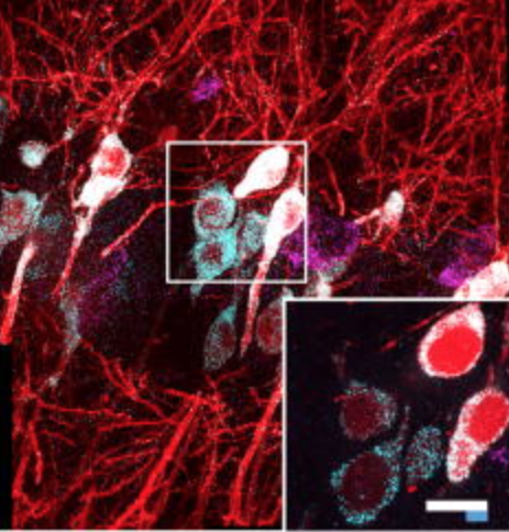Expansion microscopy - FocalPlane