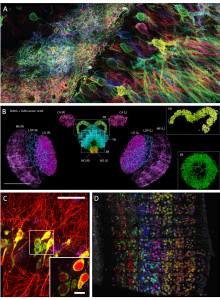 Expansion microscopy - FocalPlane