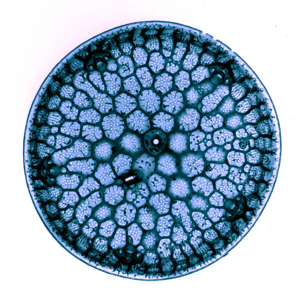 Correlative light electron microscopy (CLEM) Archives - FocalPlane