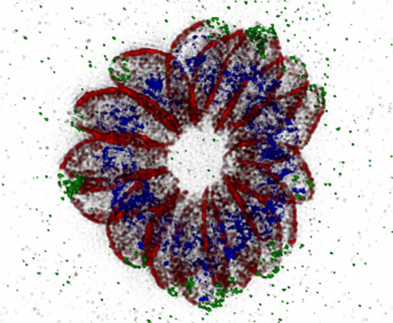 Structured Illumination Microscopy Sim Archives Focalplane 8661