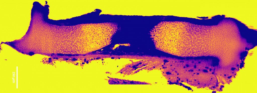 Single plane illumination microscopy (SPIM / Light sheet) Archives ...
