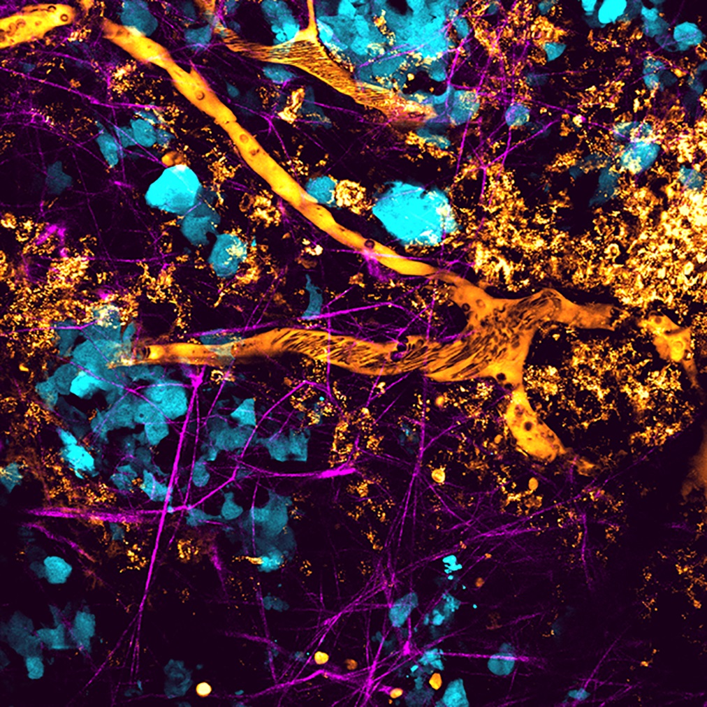 Label-free microscopy Archives - FocalPlane