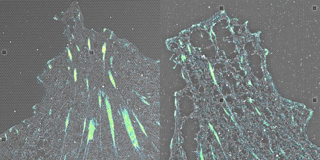 Cryo-electron microscopy (Cryo-EM) Archives - FocalPlane