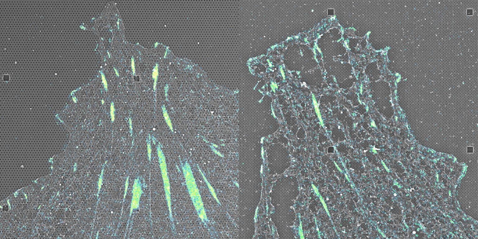 Cryo-electron microscopy (Cryo-EM) Archives - FocalPlane