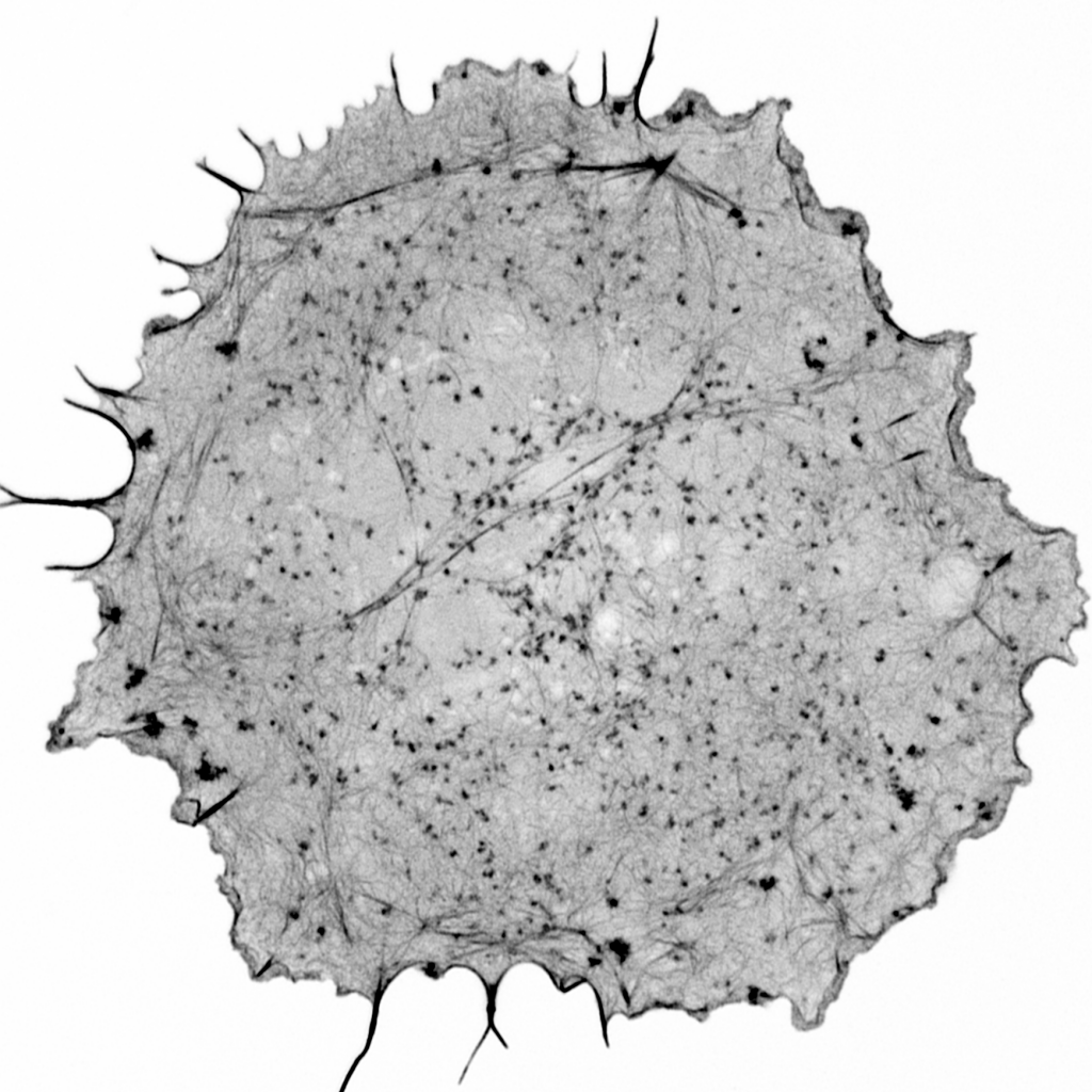 Stochastic optical reconstruction microscopy (STORM) Archives - FocalPlane