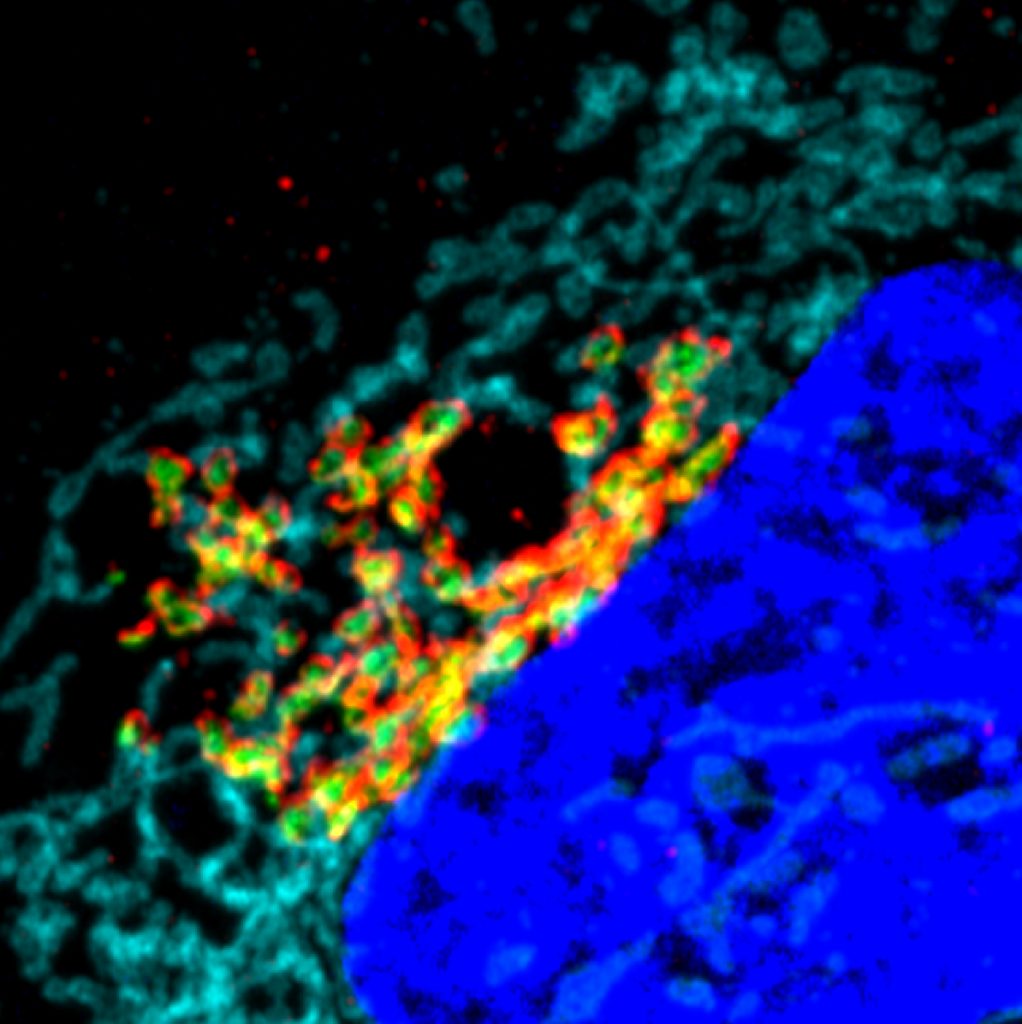 Super-resolution microscopy Archives - FocalPlane