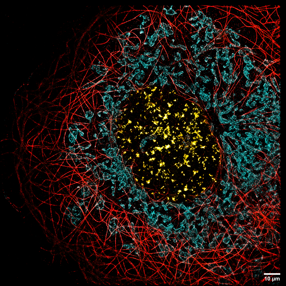 Turn Your Inverted Microscope into a Multimodal Nanoscope