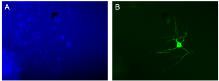 Considerations for expression of fluorescent proteins and imaging in ...