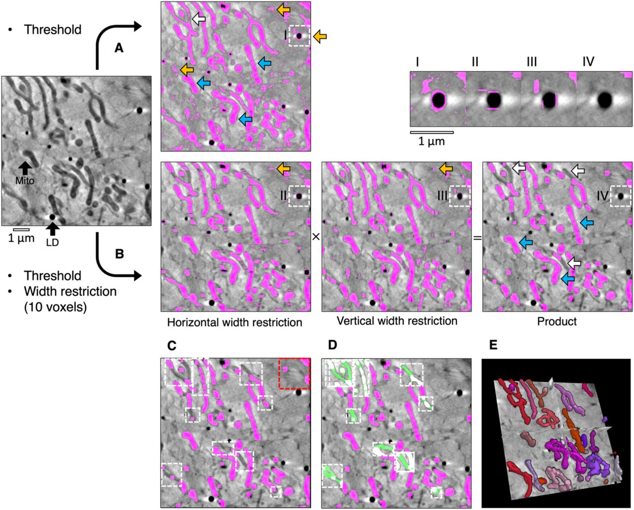 Microscopy preprints - Bioimage analysis tools - FocalPlane