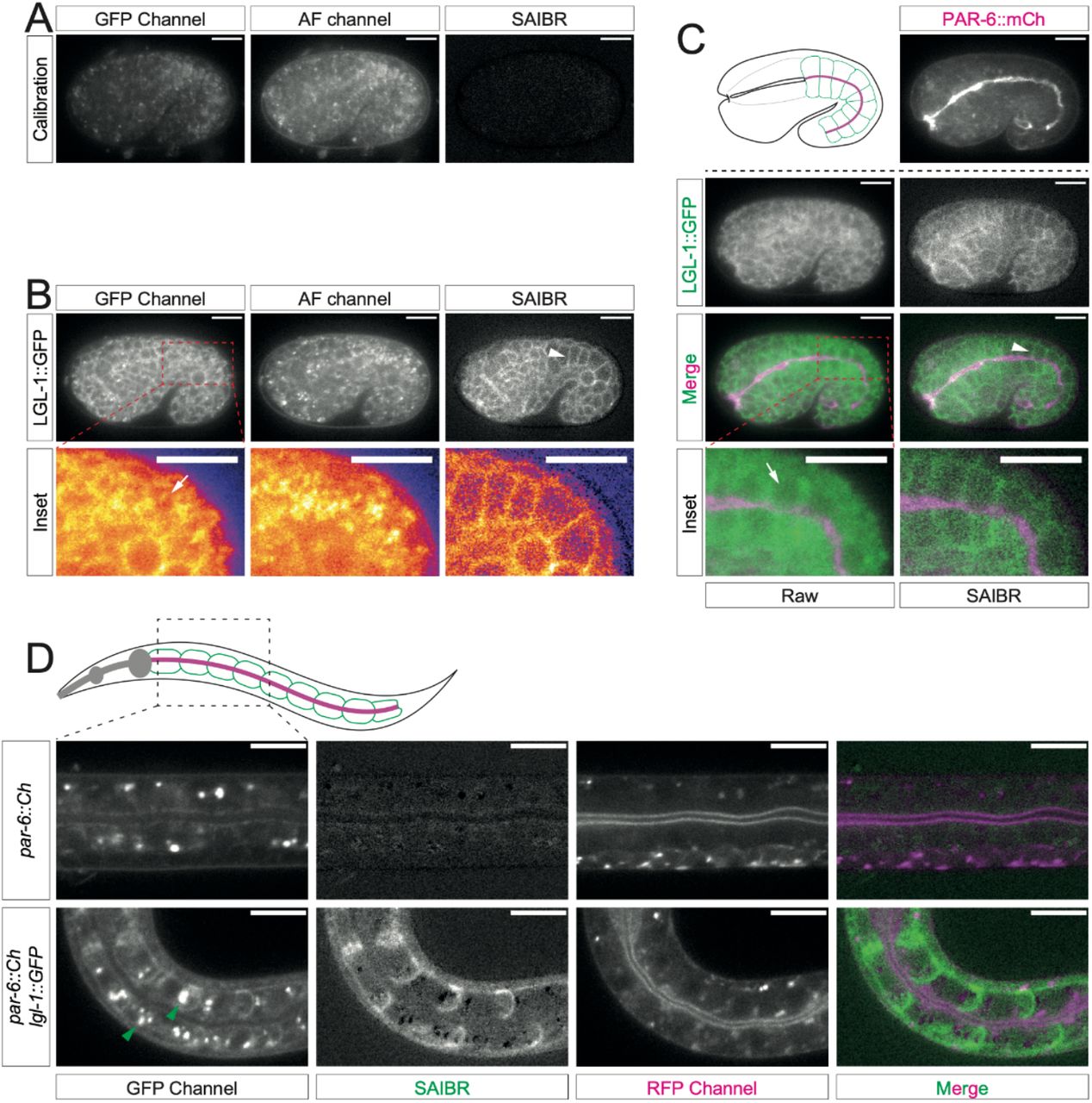 Microscopy preprints – Bioimage analysis tools