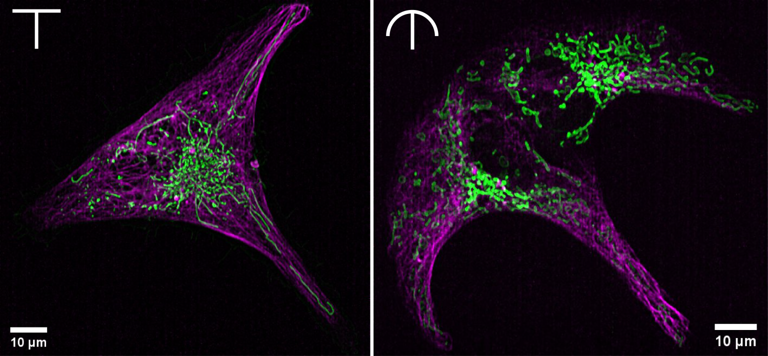 Protein micropatterning: beauty standards in cell culture - FocalPlane