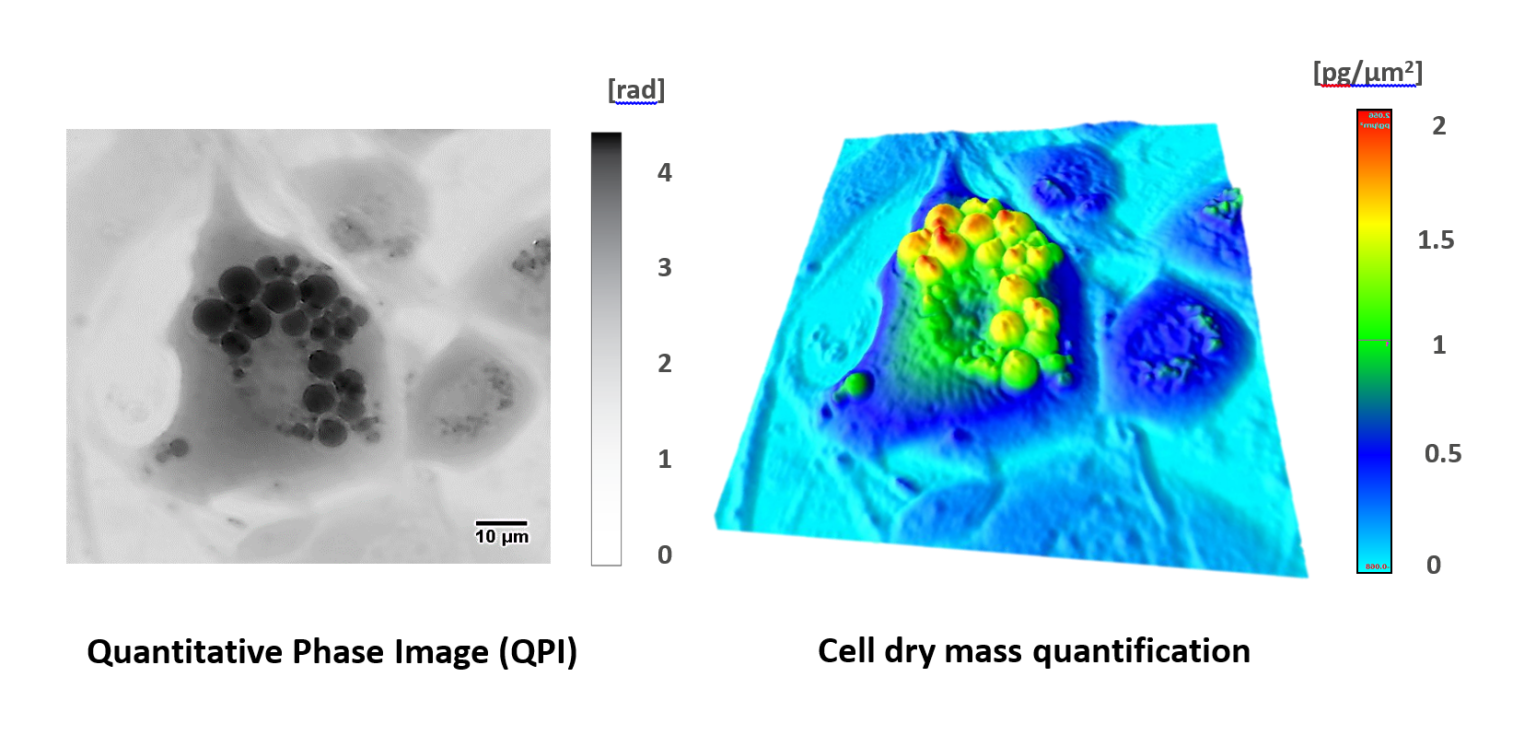 How Quantitative Phase Imaging can change the way you look at cells ...
