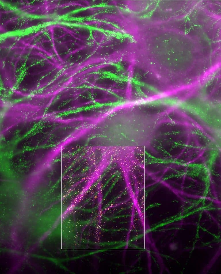 Super-resolution microscopy Archives - FocalPlane