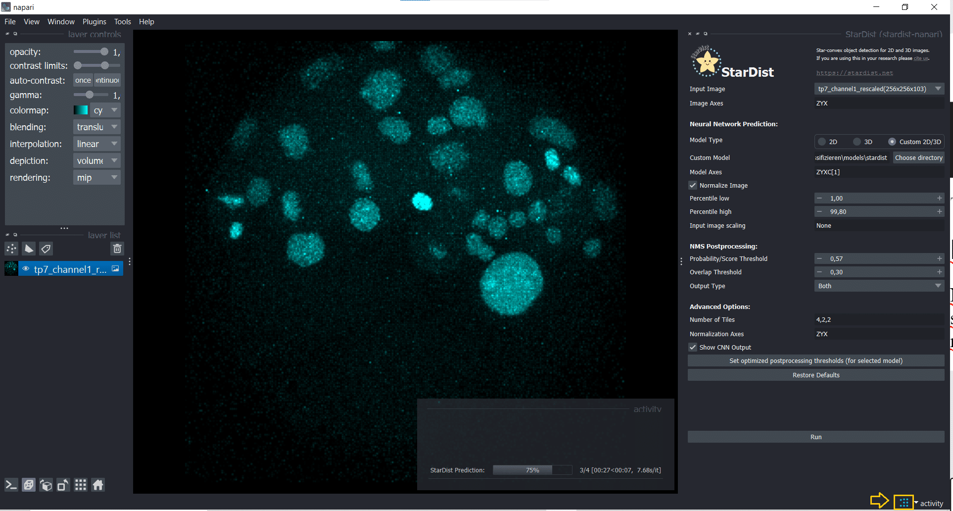 Quality assurance of segmentation results - FocalPlane