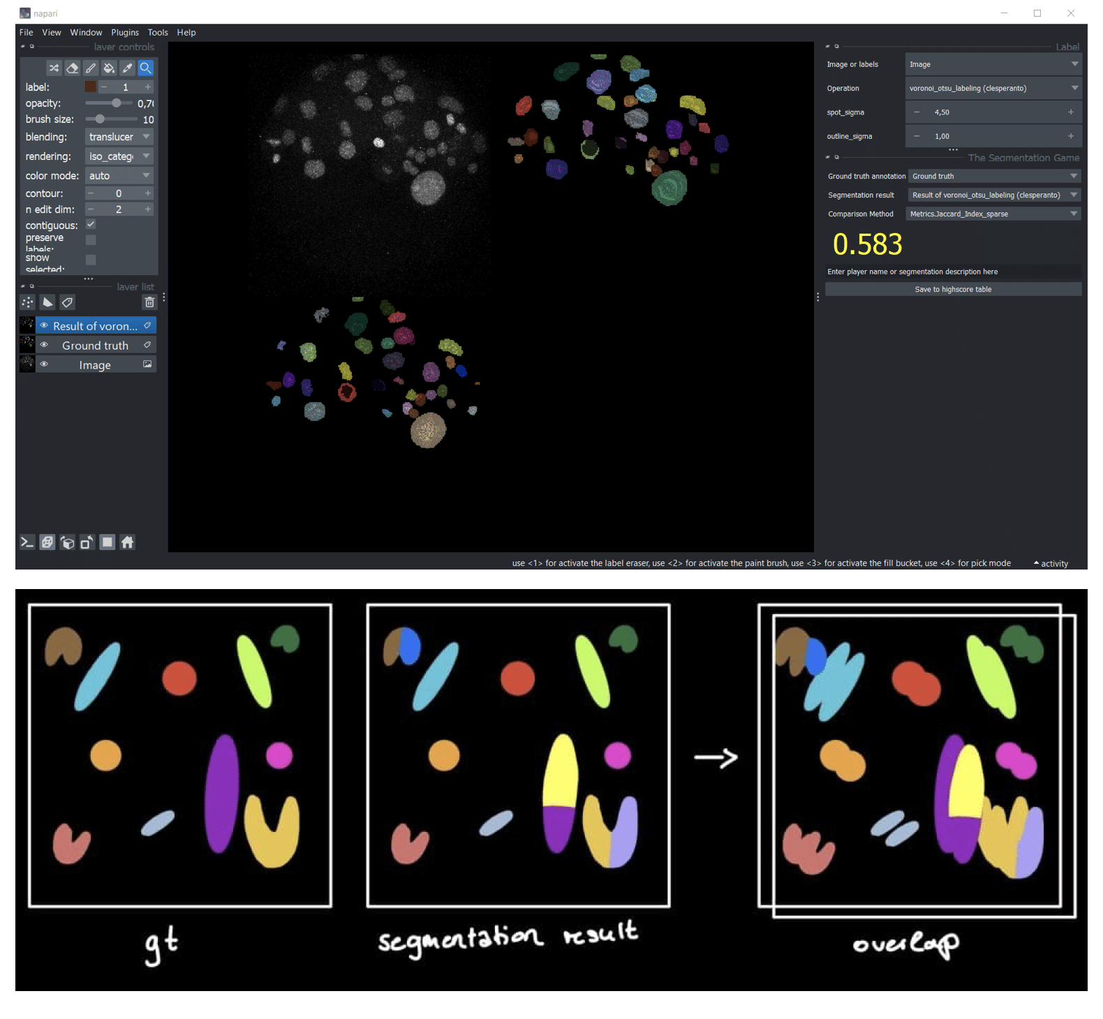 Quality assurance of segmentation results - FocalPlane