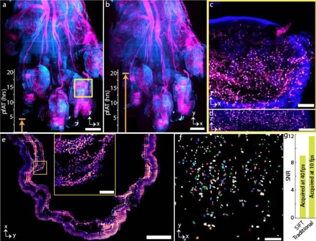 Microscopy preprints – new tools and techniques in imaging - FocalPlane