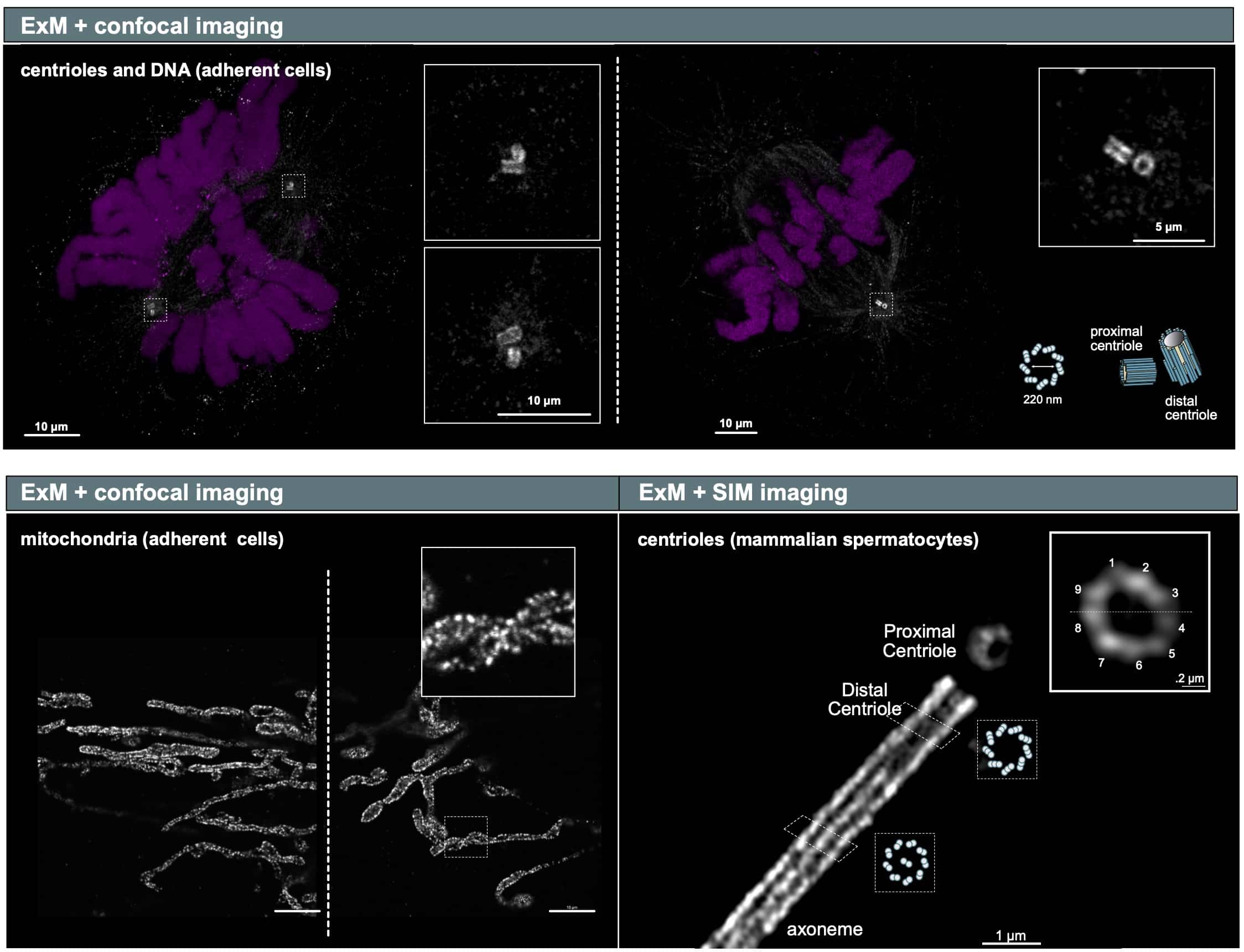 Technology Highlights - Expansion Microscopy - FocalPlane