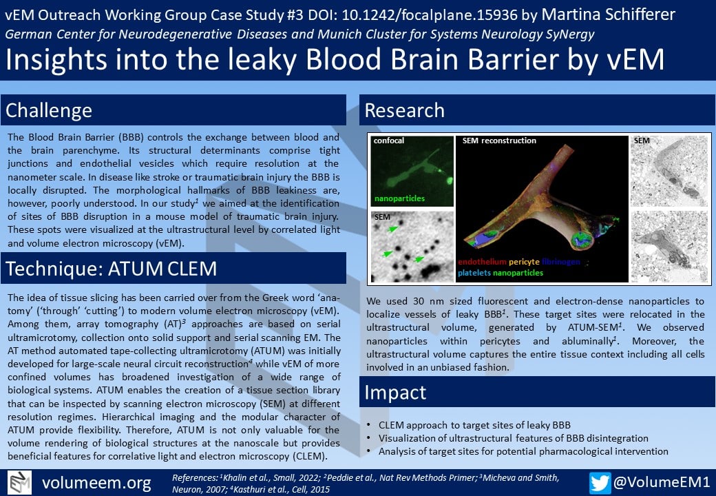 Insights into the leaky Blood Brain Barrier by vEM - FocalPlane