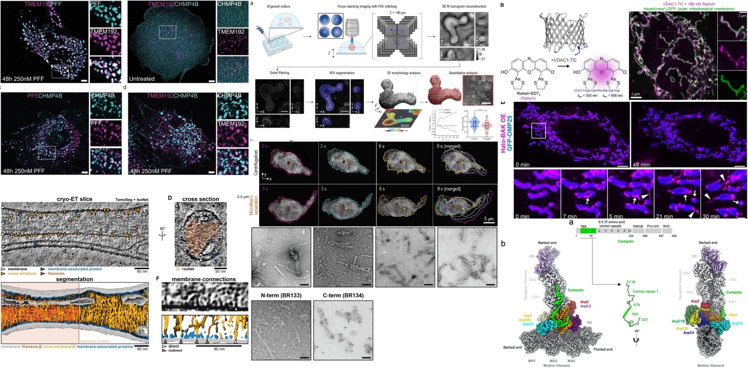 Microscopy preprints – applications in biology - FocalPlane