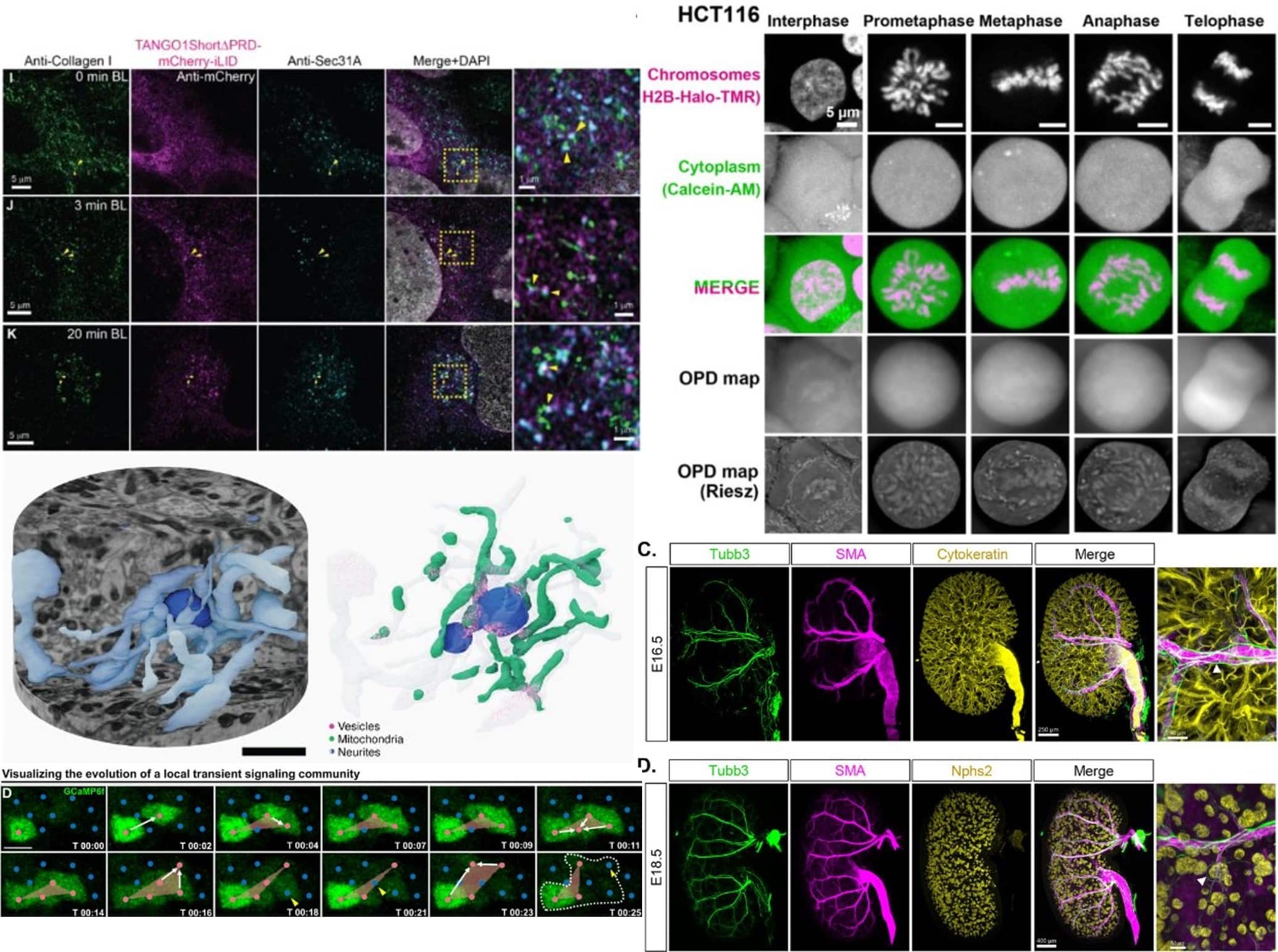 Microscopy preprints – applications in biology - FocalPlane