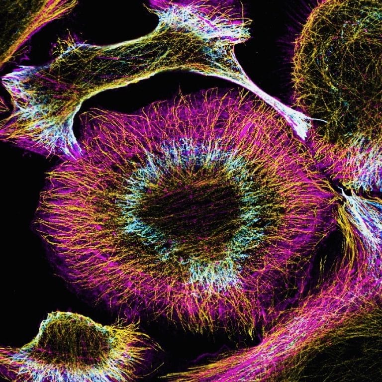 Gallery - FocalPlane