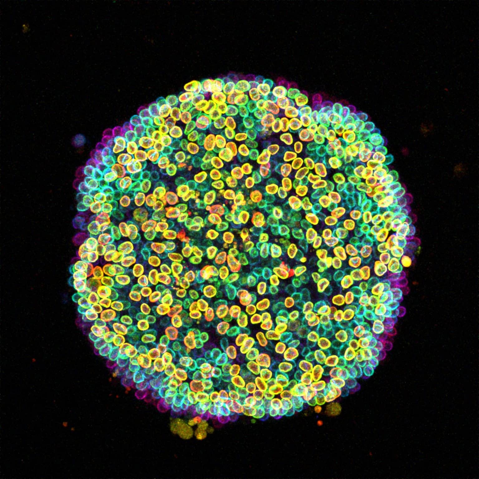 Gallery - FocalPlane