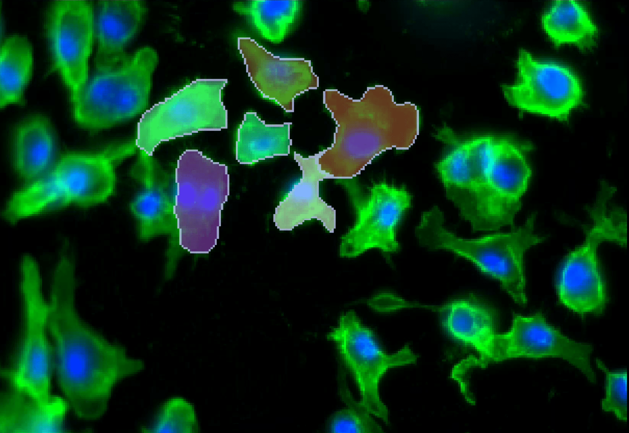 Annotating Images in Cellpose - FocalPlane