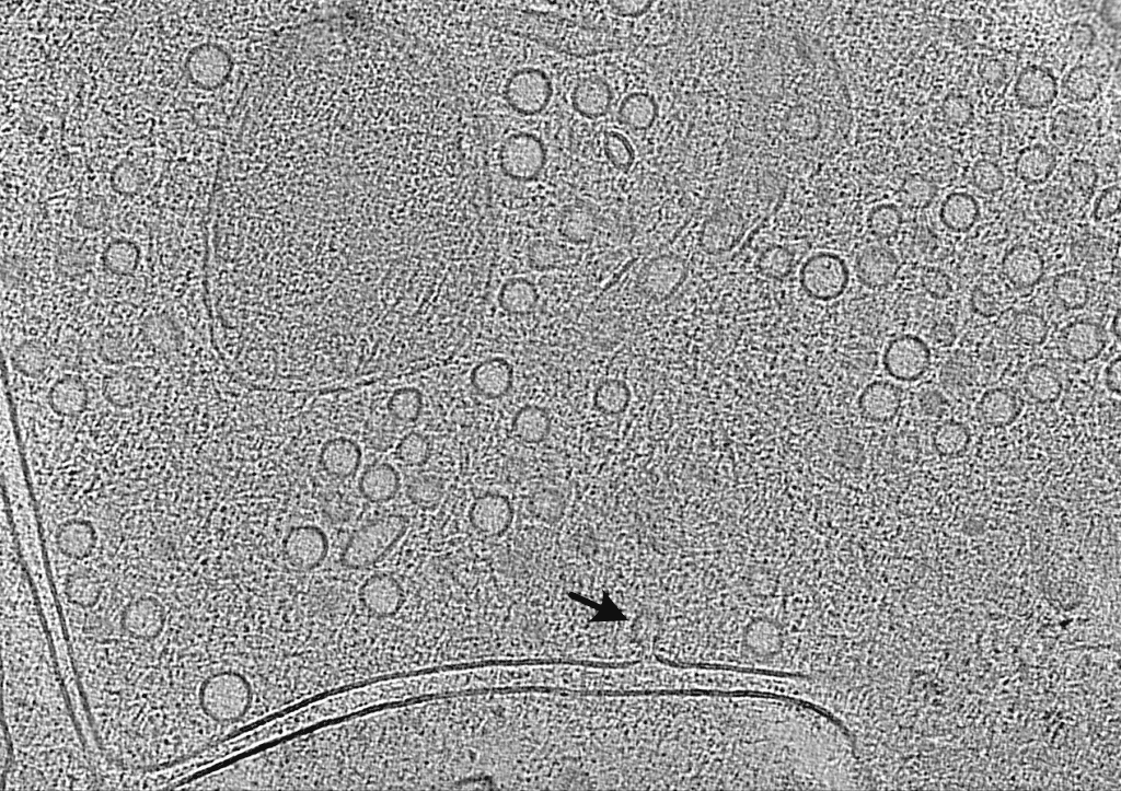 Imaging spotlight: visualising synaptic vesicle fusion by cryo-ET ...