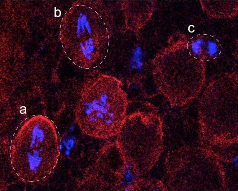Seeing Chromatin Scaling with Cell Size, from Interphase to Mitosis ...